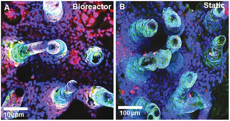 3D Printed Artificial Small Intestine to Advance Research on Gut ...