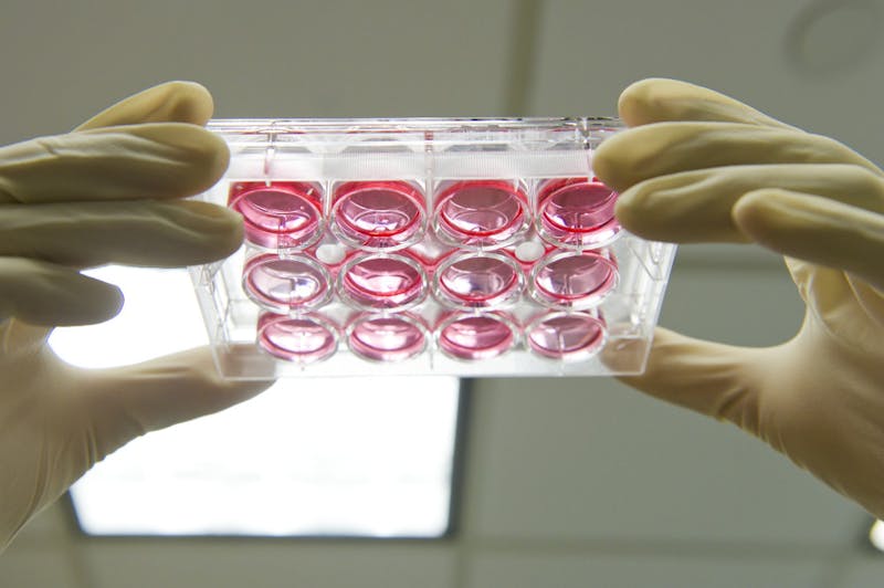 Researchers Explain Mechanism Controlling Cell Protein Generation - The ...