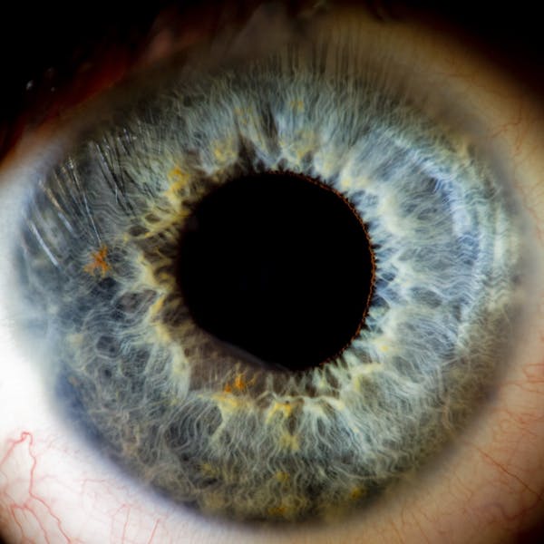 Hopkins alum Lori Grover speaks on importance of optometry - The Johns ...