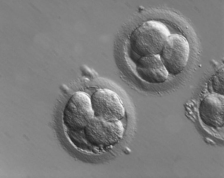 Study on chromosomal abnormalities sheds light on in early embryo ...