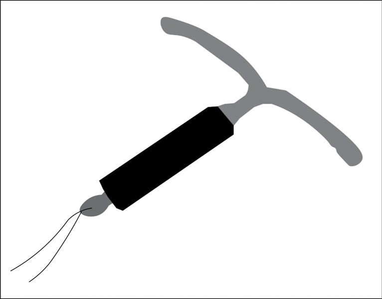 IUD Illustration - The Post